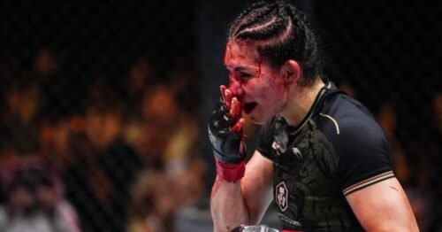 UFC Doctor Shares Horror Pictures of the ‘Worst Cut in History’ | MMA UK