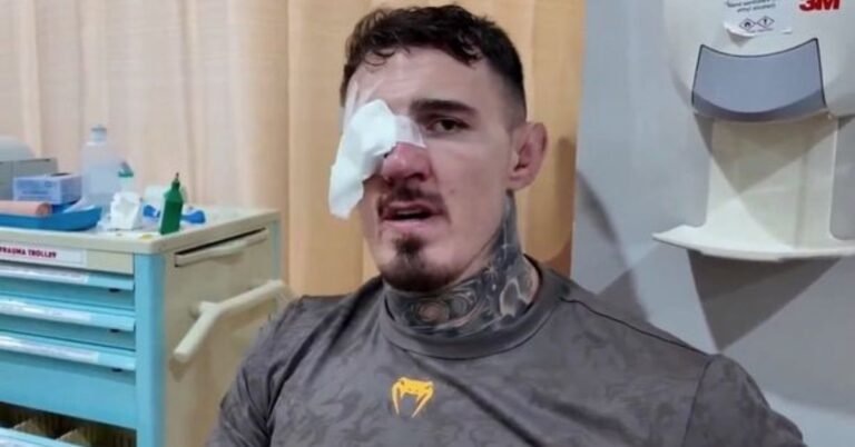 Tom Aspinall UFC 321 Injury: Champion Battles Vision Issues After No ...